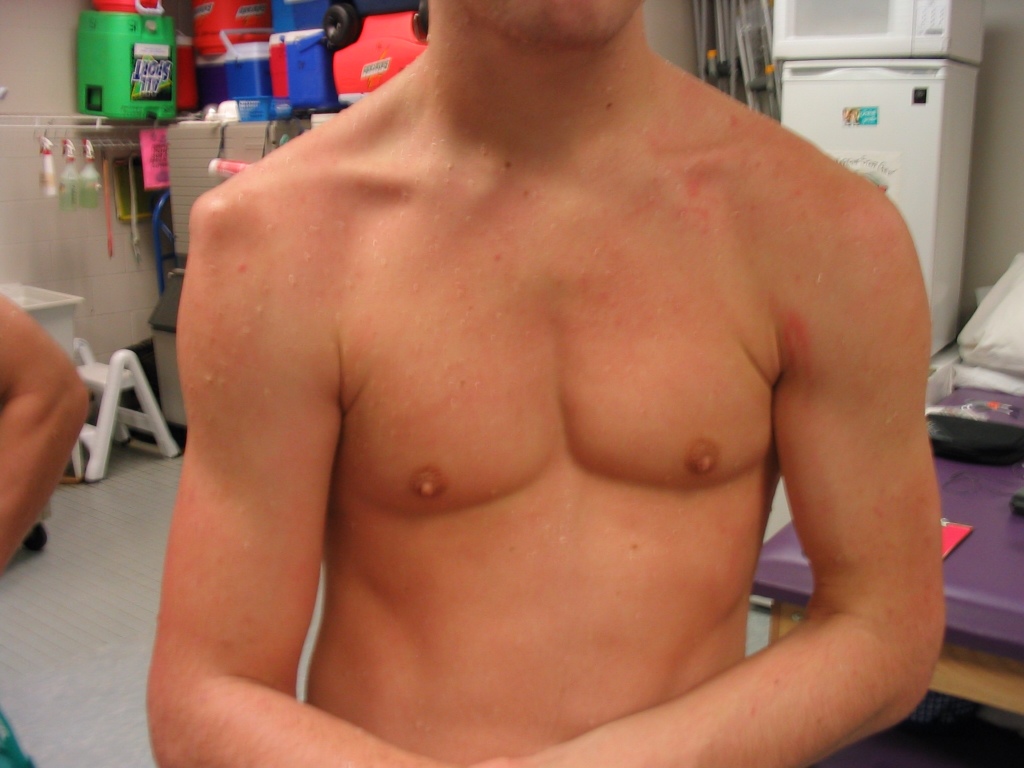 Shoulder Dislocation Core EM