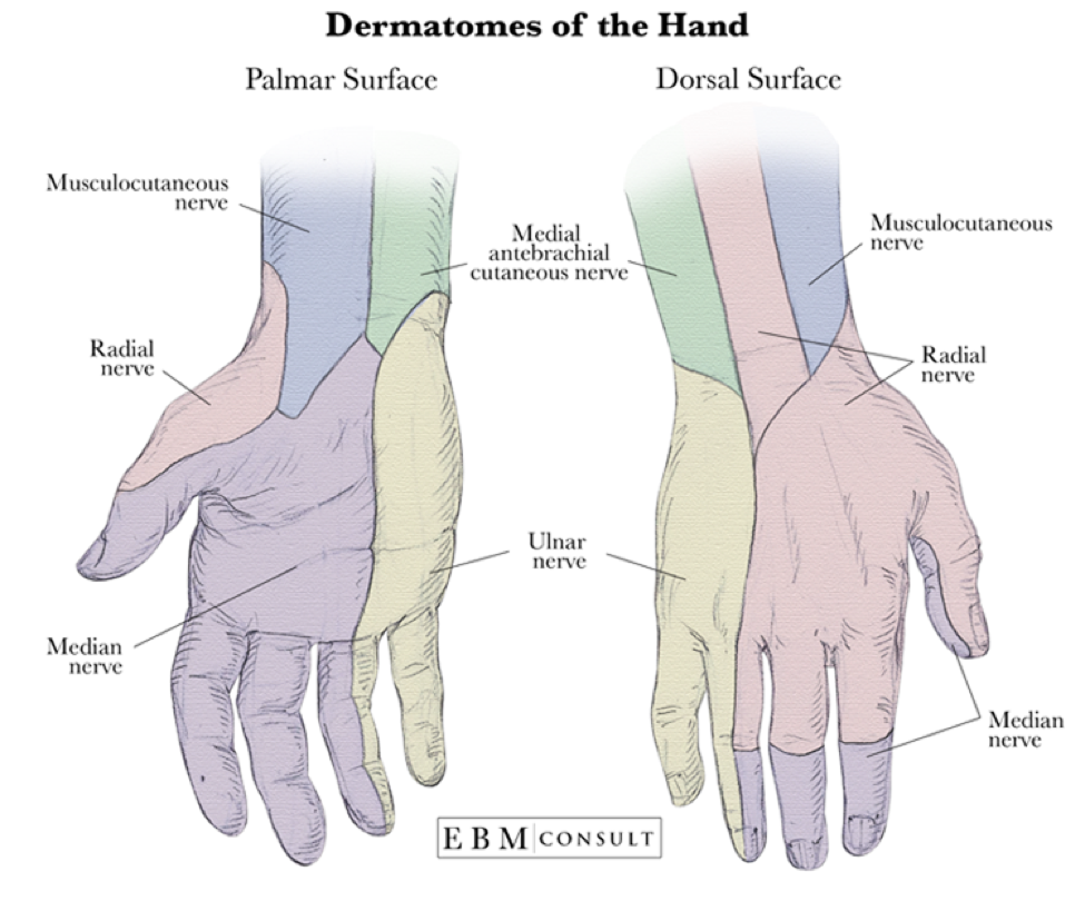 Metacarpal Fractures Core EM